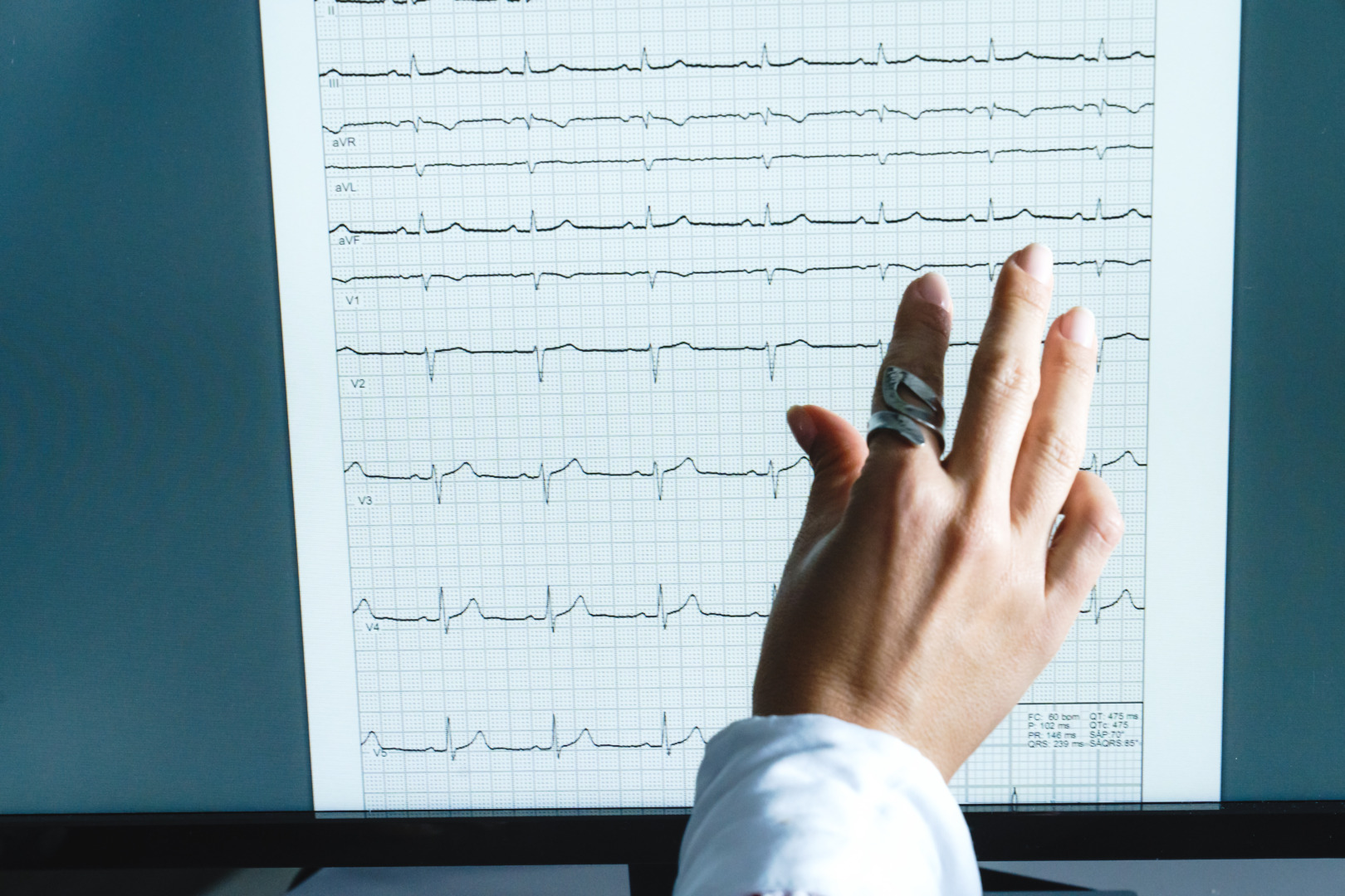 How telemedicine the execution of ECG with reports - Telemedicina