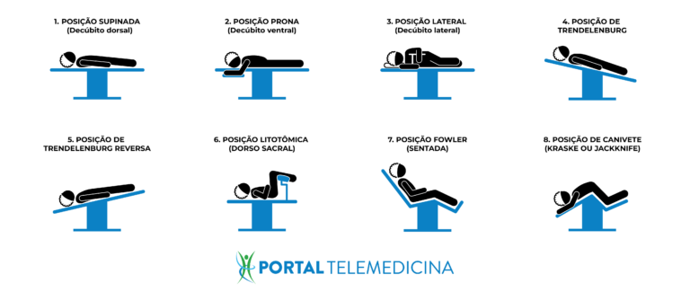 Tudo sobre posições cirúrgicas - Portal Telemedicina